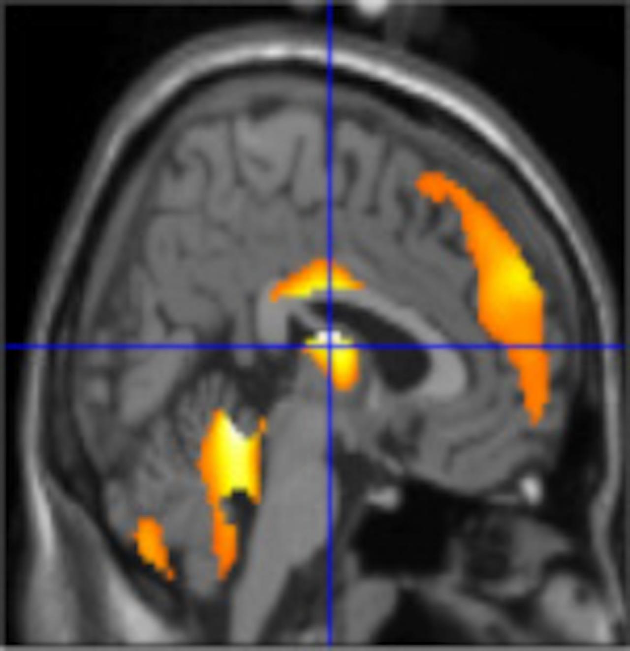 Diagnosis | Lyme Disease