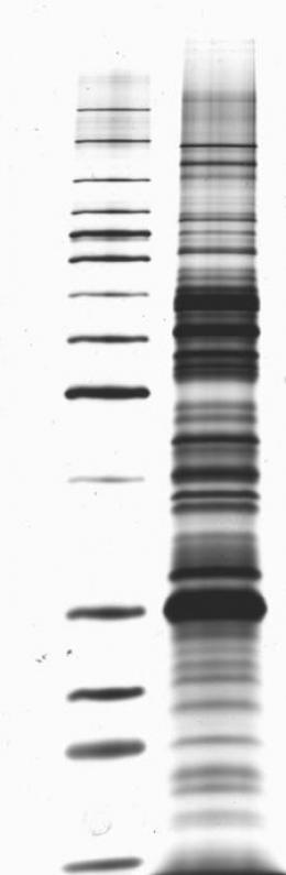 Diagnosis | Lyme Disease