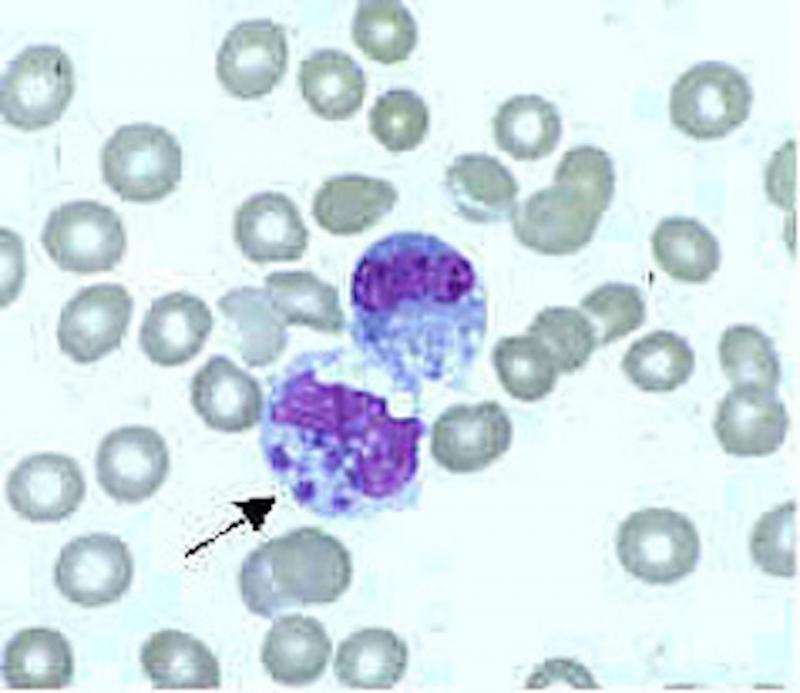 Ehrlichiosis | Lyme Disease